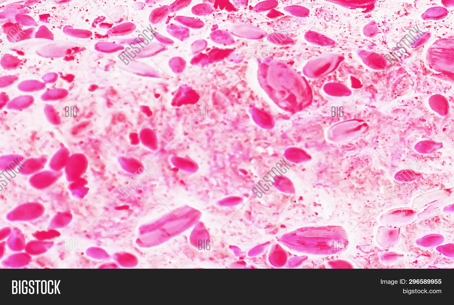 Bacteria Under Image & Photo (Free Trial) | Bigstock