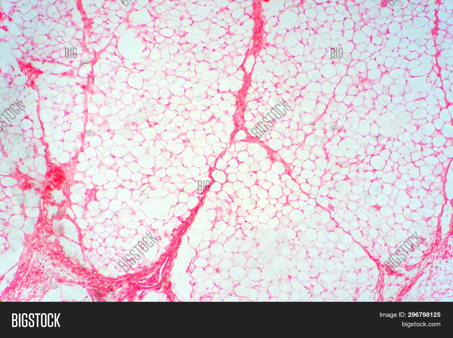 Human Fat Body Tissue Image & Photo (Free Trial) | Bigstock