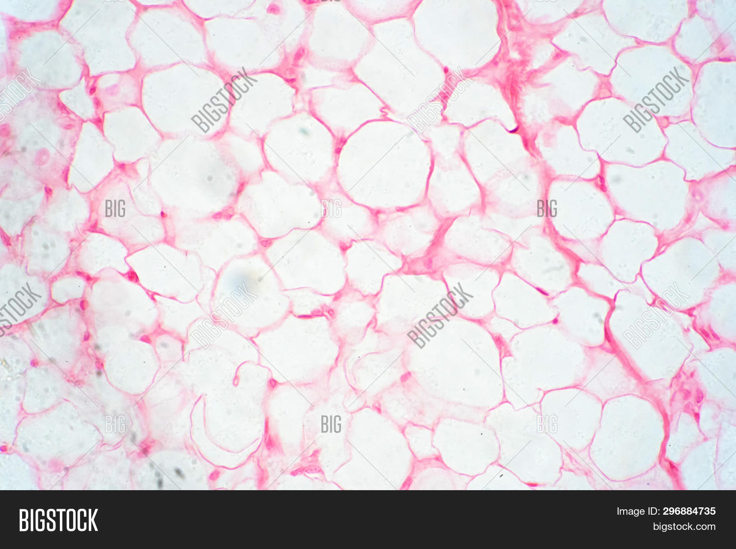 Human Fat Body 图片和照片（免费试用） | Bigstock