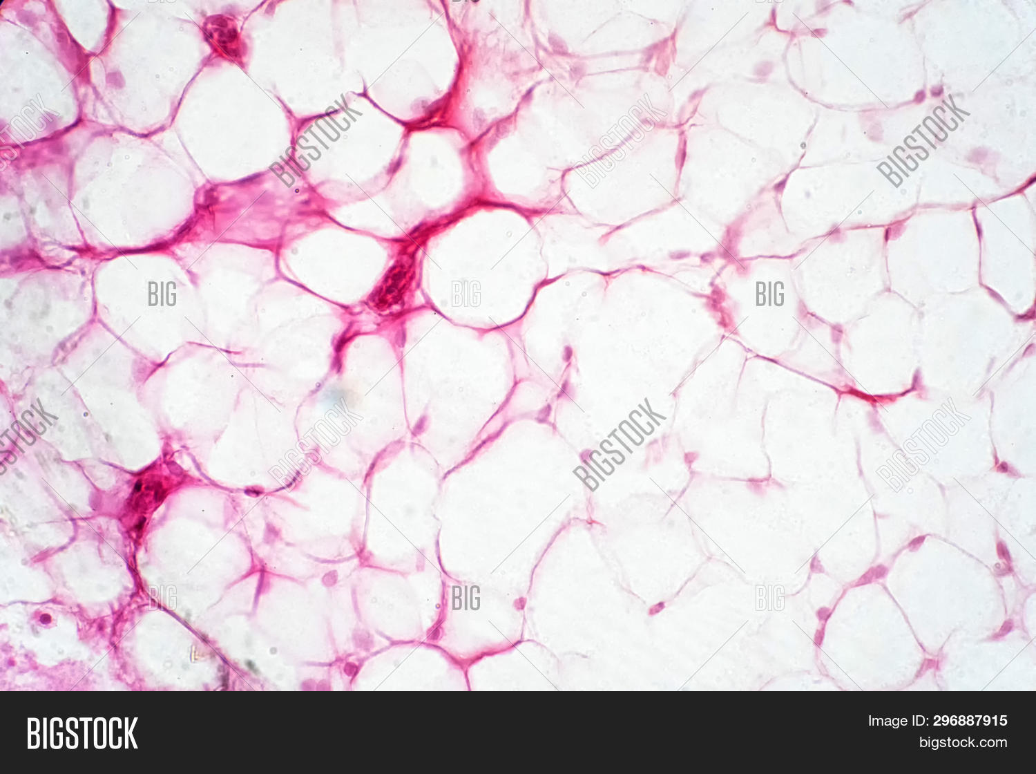 Human Fat Body Tissue Image & Photo (Free Trial) | Bigstock