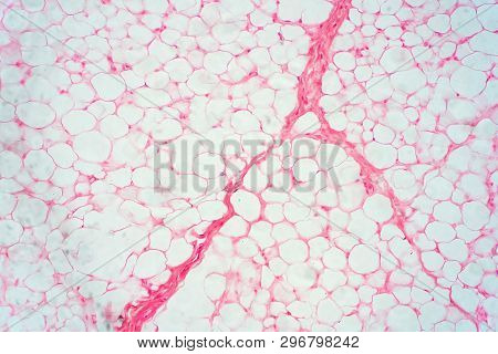 Human Fat Body Tissue Image & Photo (Free Trial) | Bigstock