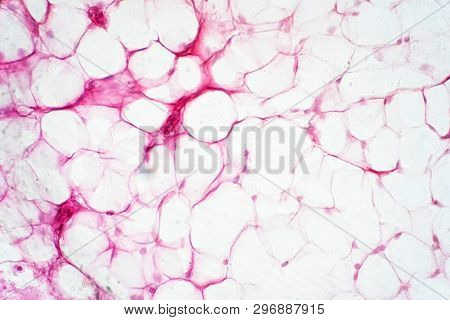 Human Fat Body Tissue Image & Photo (Free Trial) | Bigstock