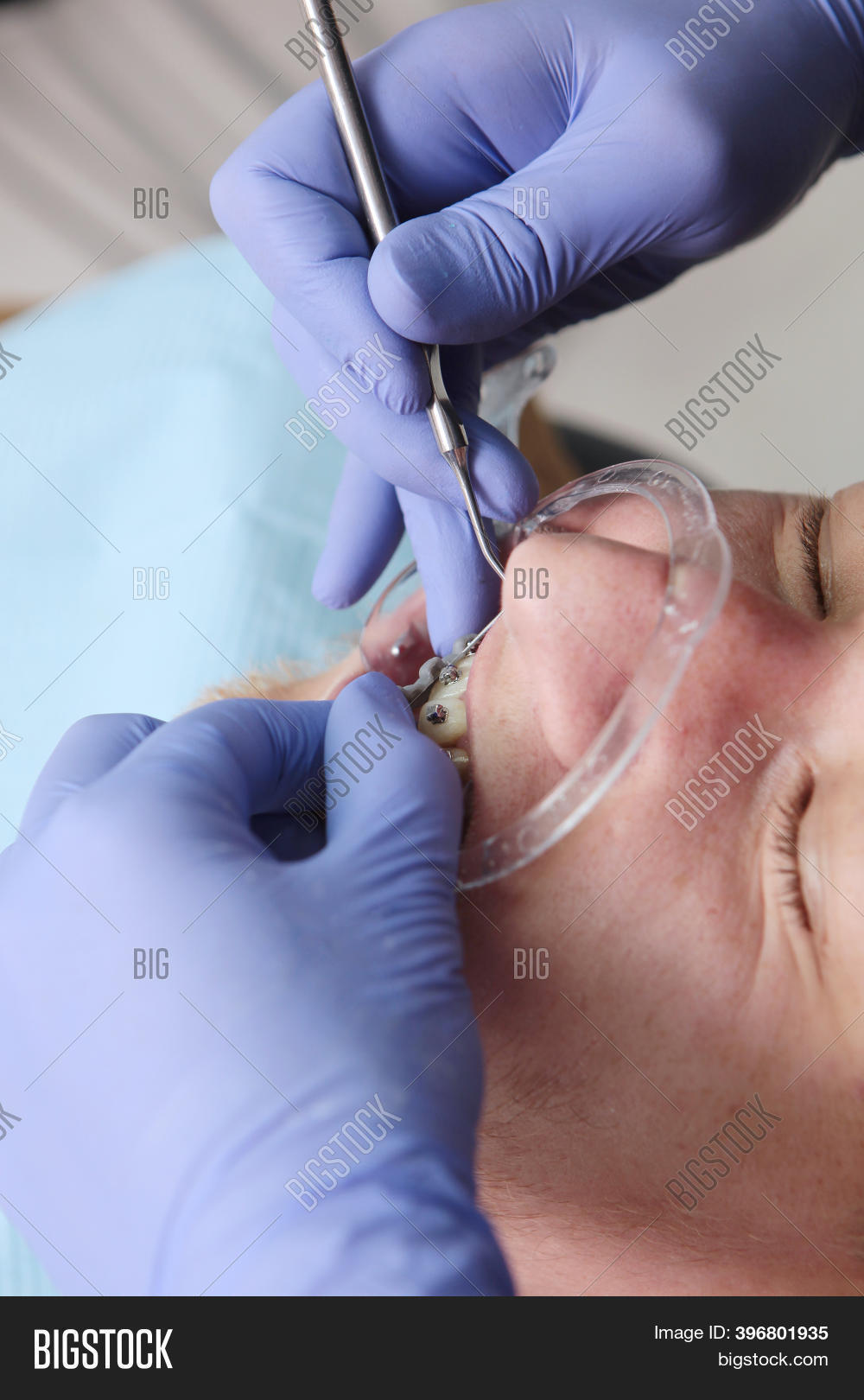 Correction Image & Photo (Free Trial) | Bigstock