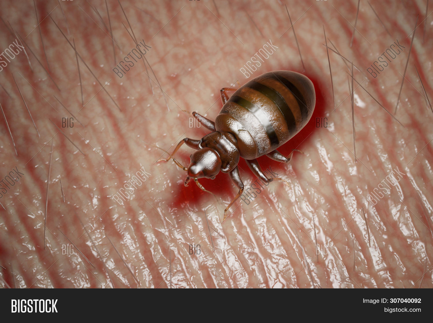 3d Rendered Medically Image & Photo (Free Trial) | Bigstock