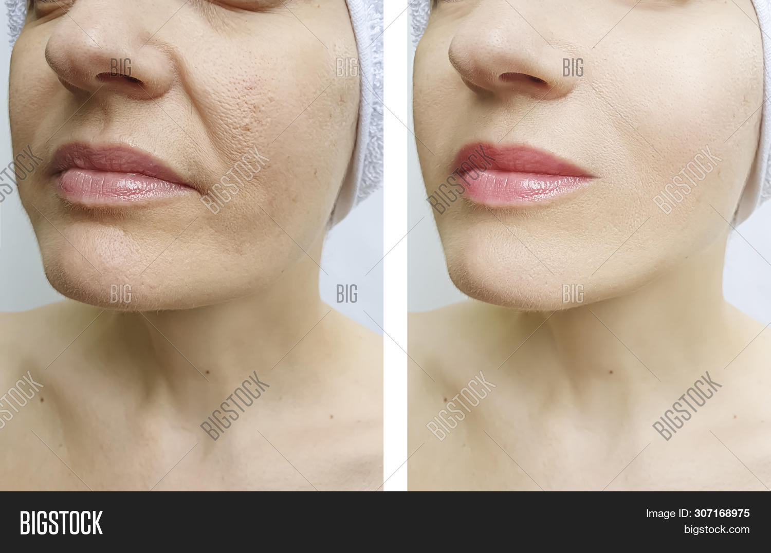 Woman Face Wrinkles Image & Photo (Free Trial) | Bigstock