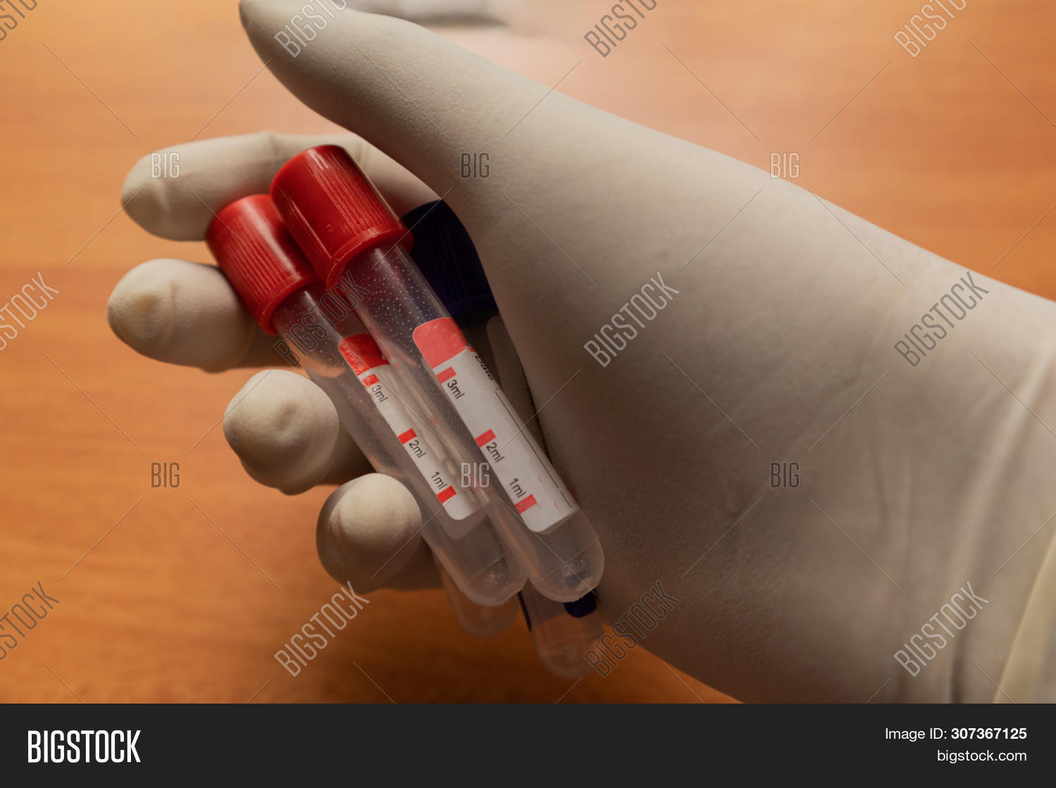 Pro-coagulation Plain Image & Photo (Free Trial) | Bigstock