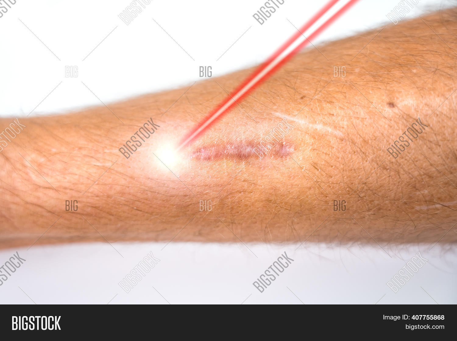 Man Leg Laser Beam Image & Photo (Free Trial) | Bigstock