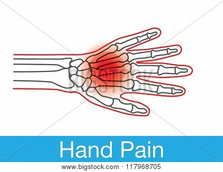 Hand Pain Outline Vector & Photo (Free Trial) | Bigstock