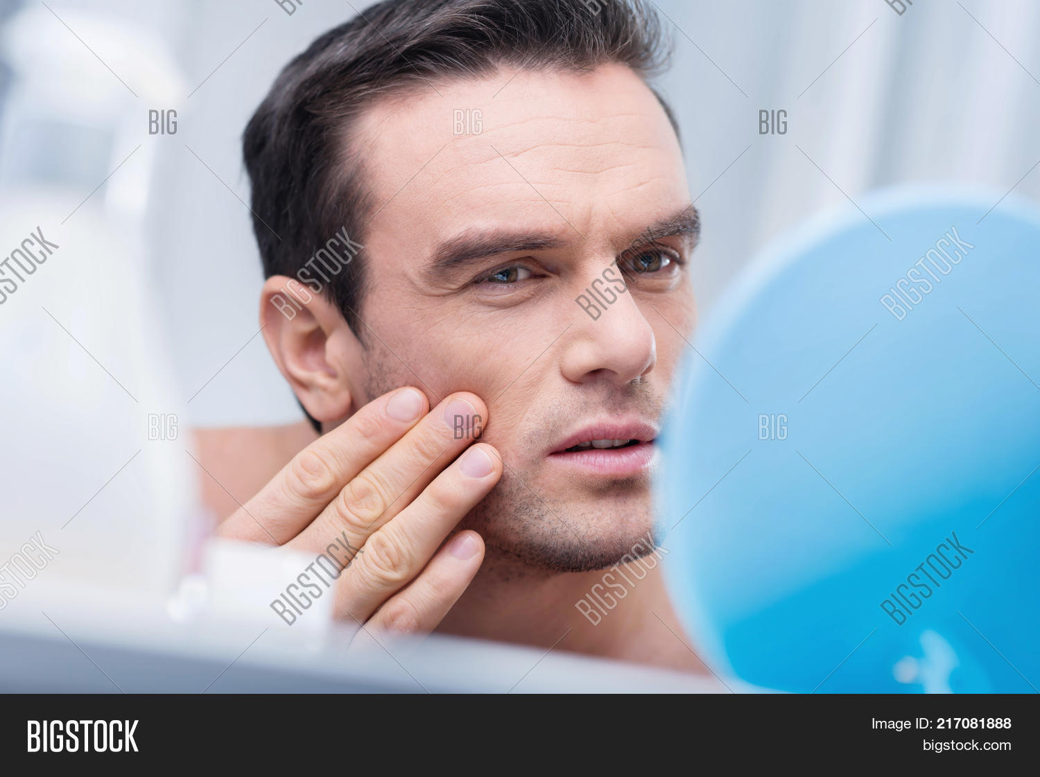 Skin Imperfections. Image & Photo (Free Trial) | Bigstock