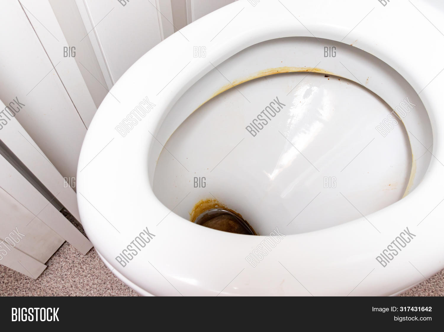 Dirty Unhygienic Image & Photo (Free Trial) | Bigstock
