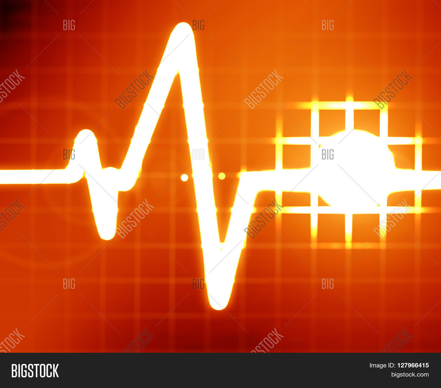 Heart Monitor Image & Photo (Free Trial) | Bigstock