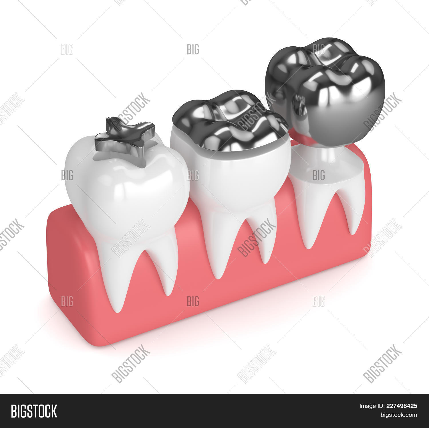 3D Render Teeth Image & Photo (Free Trial) | Bigstock