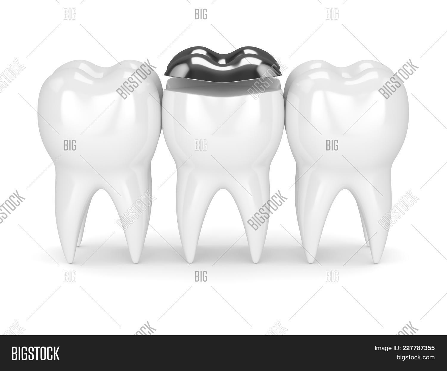 3d Render Teeth Dental Image & Photo (Free Trial) | Bigstock