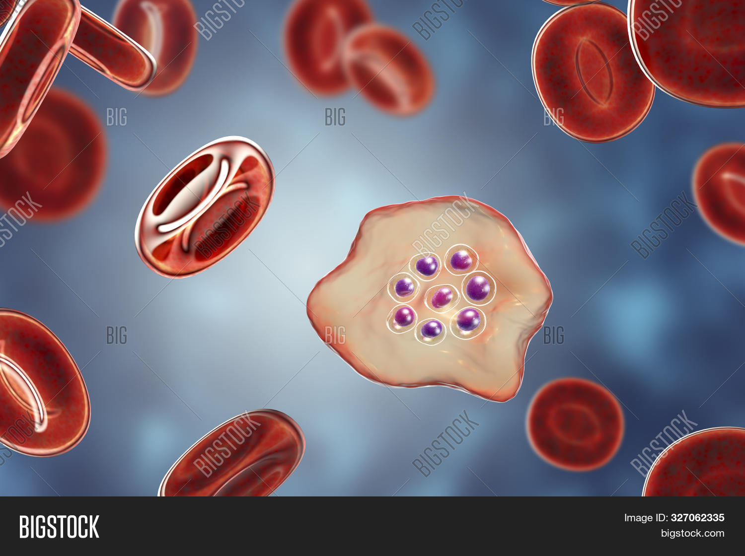 Malaria-infected Red Image & Photo (Free Trial) | Bigstock