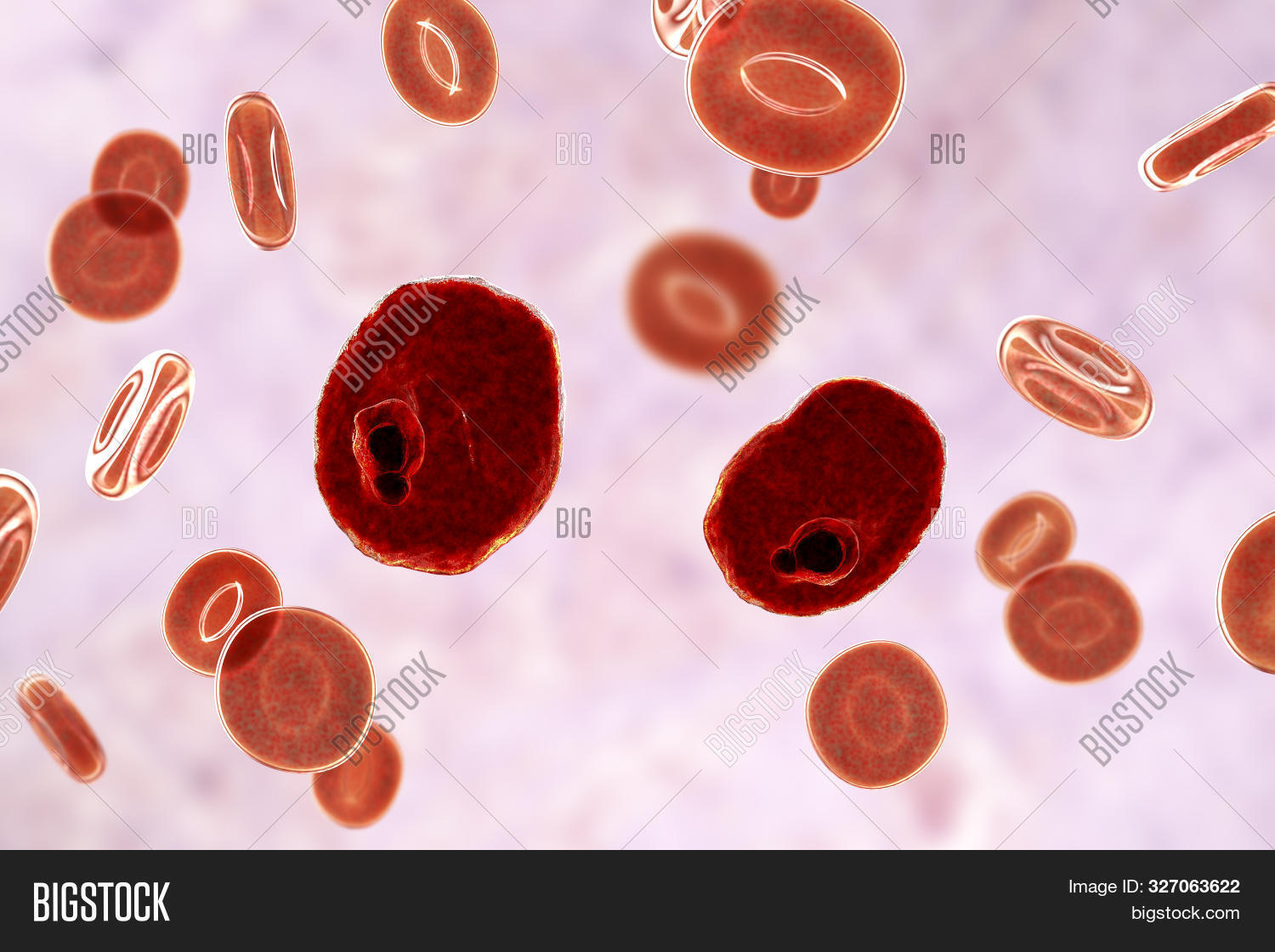 Malaria-infected Red Image & Photo (Free Trial) | Bigstock