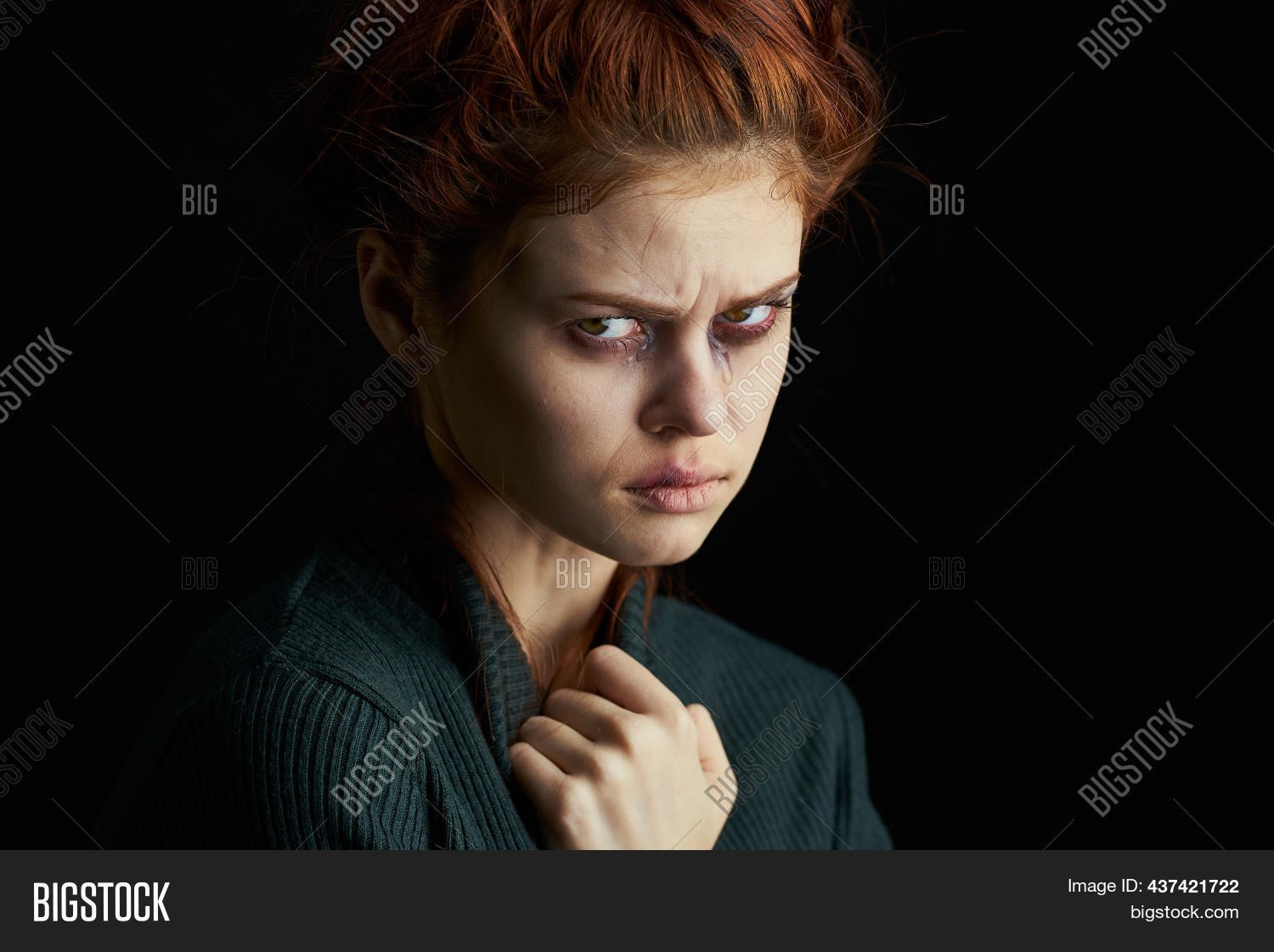 Crying Woman Black Eye Image & Photo (Free Trial) | Bigstock