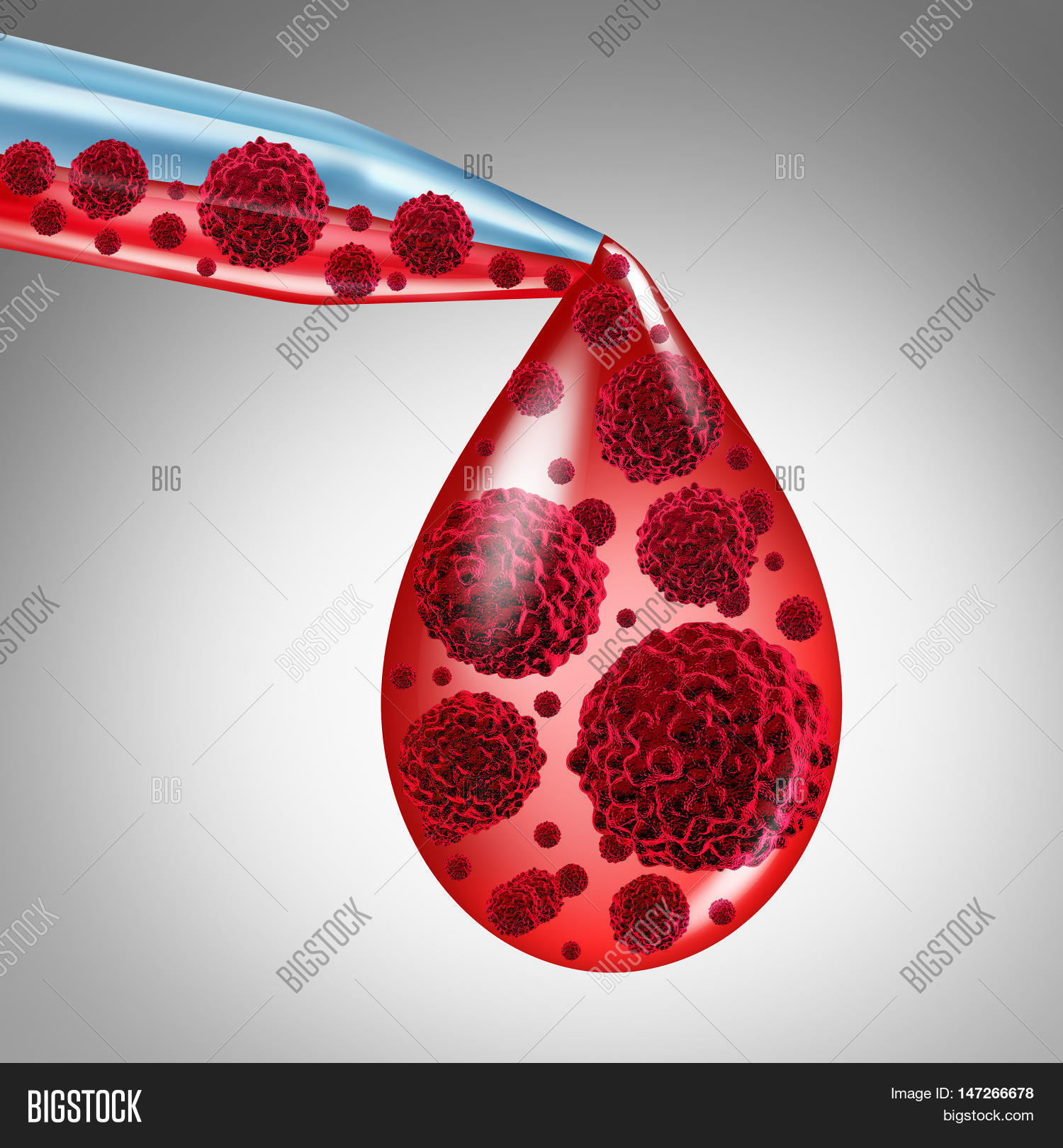 Blood Cancer Medical Image & Photo (Free Trial) | Bigstock