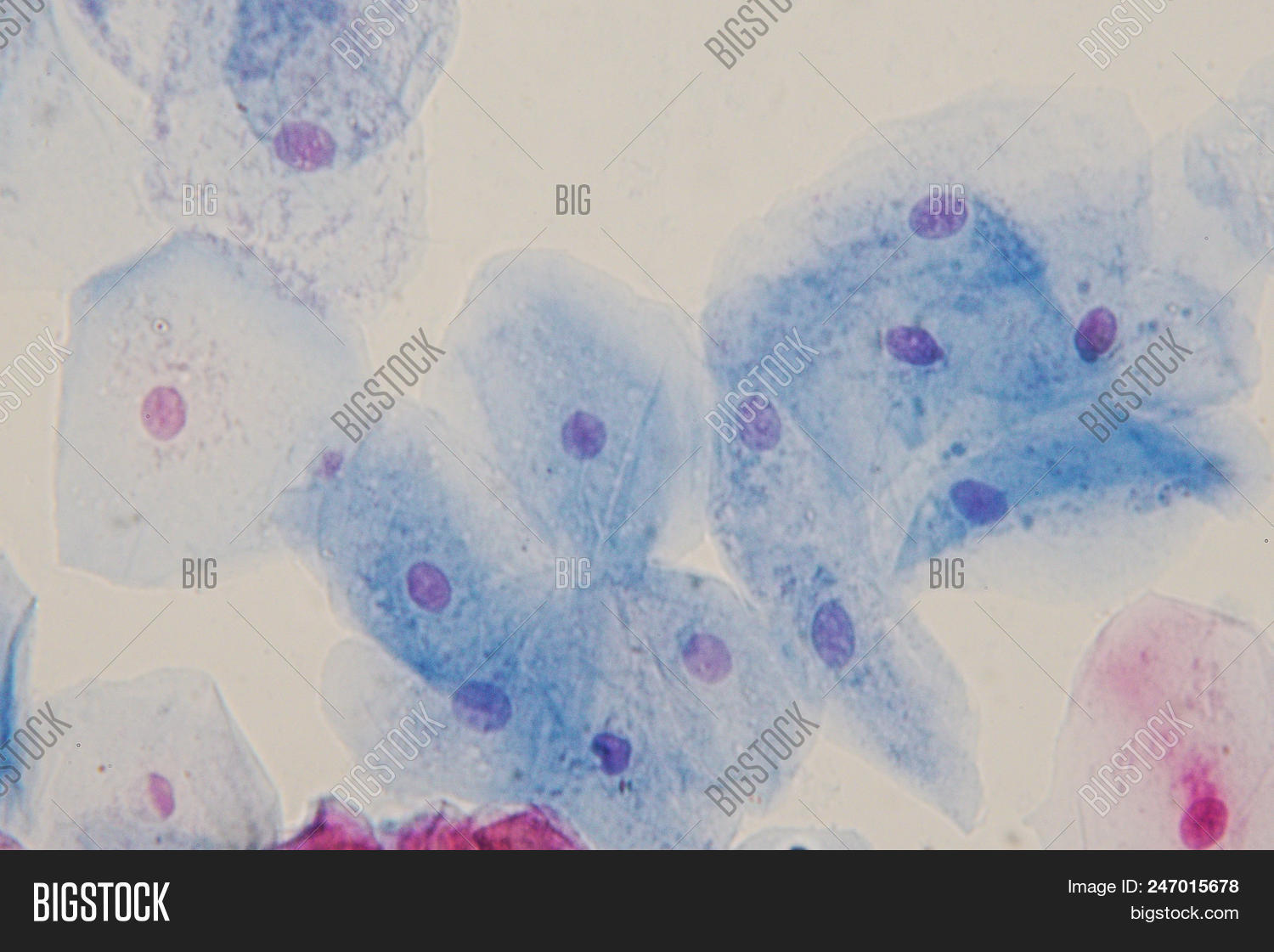 Squamous Epithelial Image & Photo (Free Trial) | Bigstock