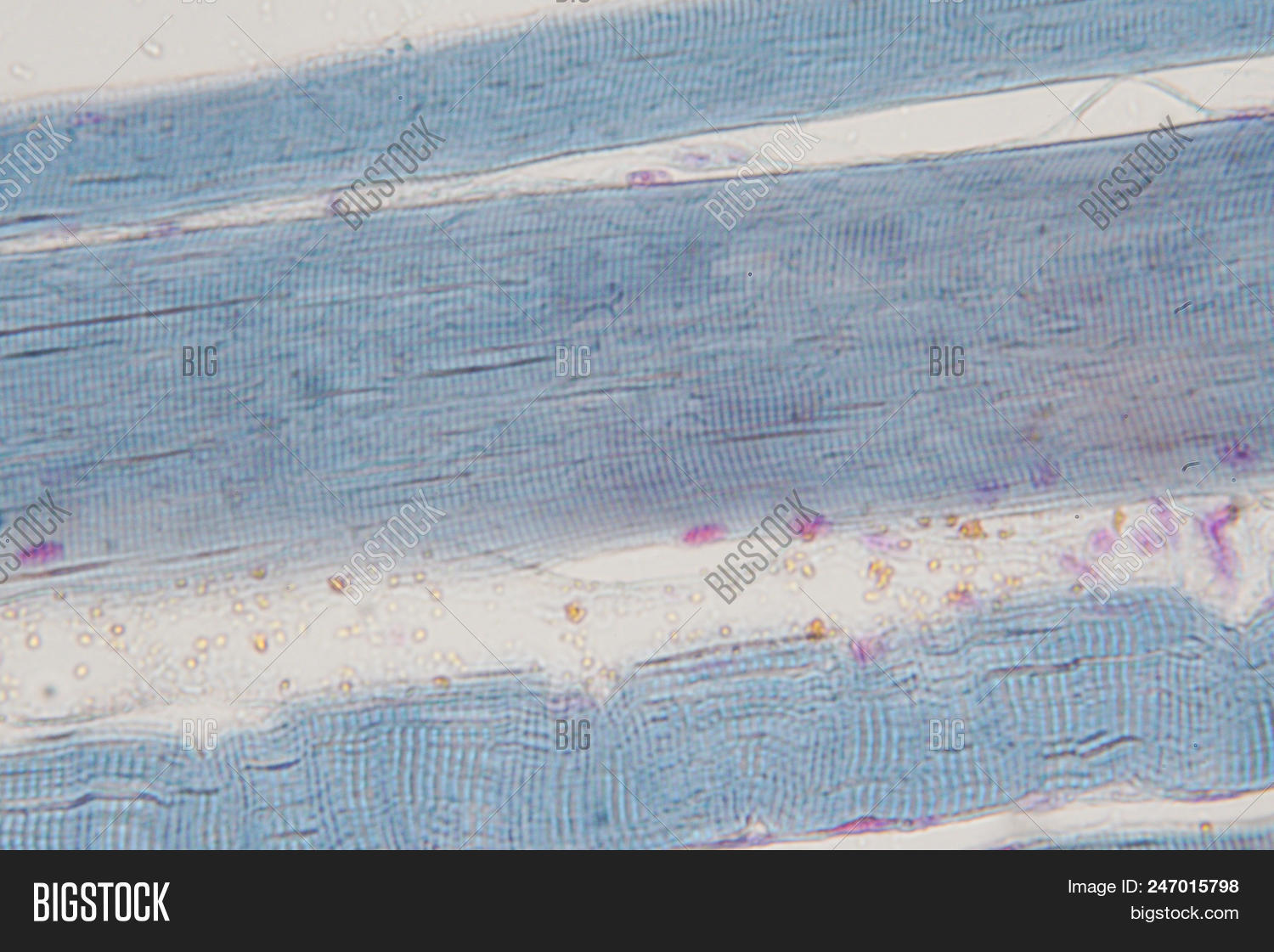 Human Skeletal Muscle Image & Photo (Free Trial) | Bigstock