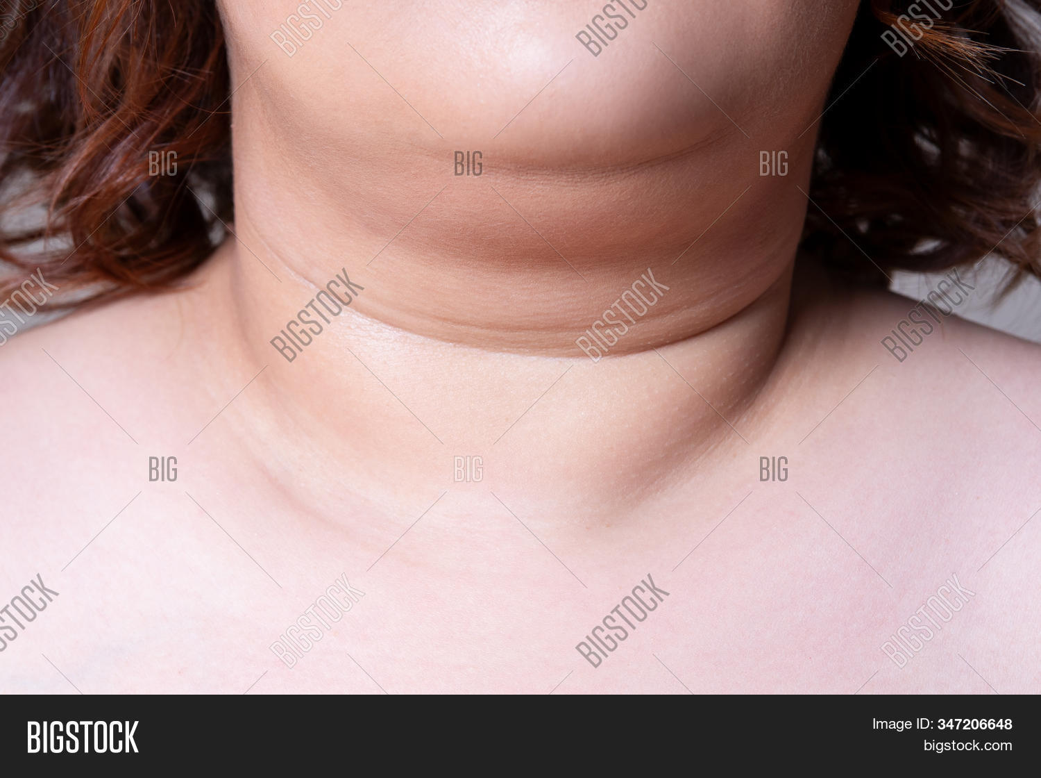 Flabby Skin On Neck Image & Photo (Free Trial) | Bigstock