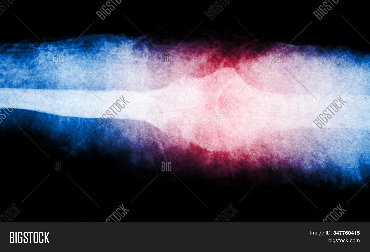 Knee X Ray Scan. Red Image & Photo (Free Trial) | Bigstock