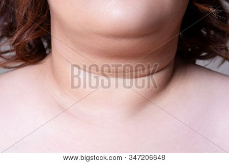 Flabby Skin On Neck Image & Photo (Free Trial) | Bigstock