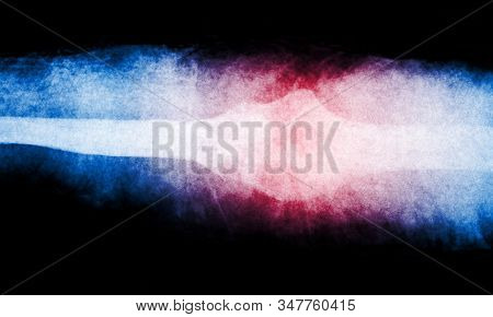 Knee X Ray Scan. Red Image & Photo (Free Trial) | Bigstock