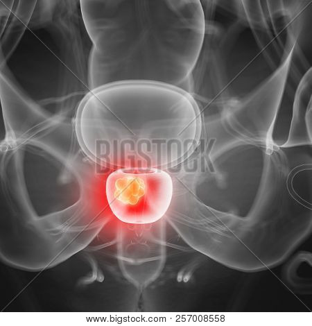 3d Rendered Medically Image & Photo (Free Trial) | Bigstock