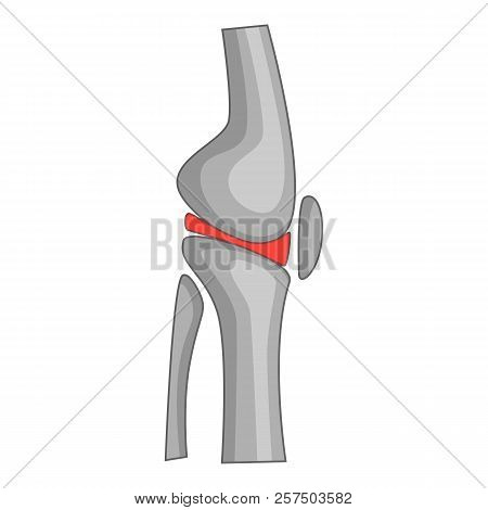 Total Knee Replacement Image & Photo (Free Trial) | Bigstock
