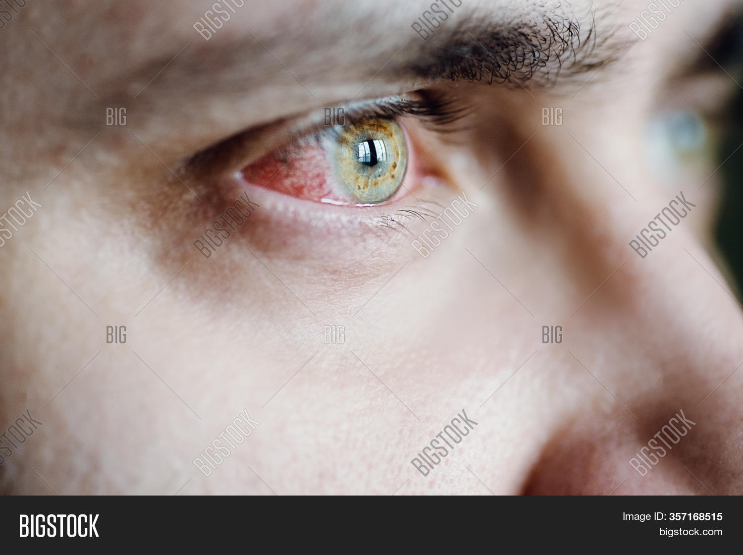 Closeup Red Eye Image & Photo (Free Trial) | Bigstock