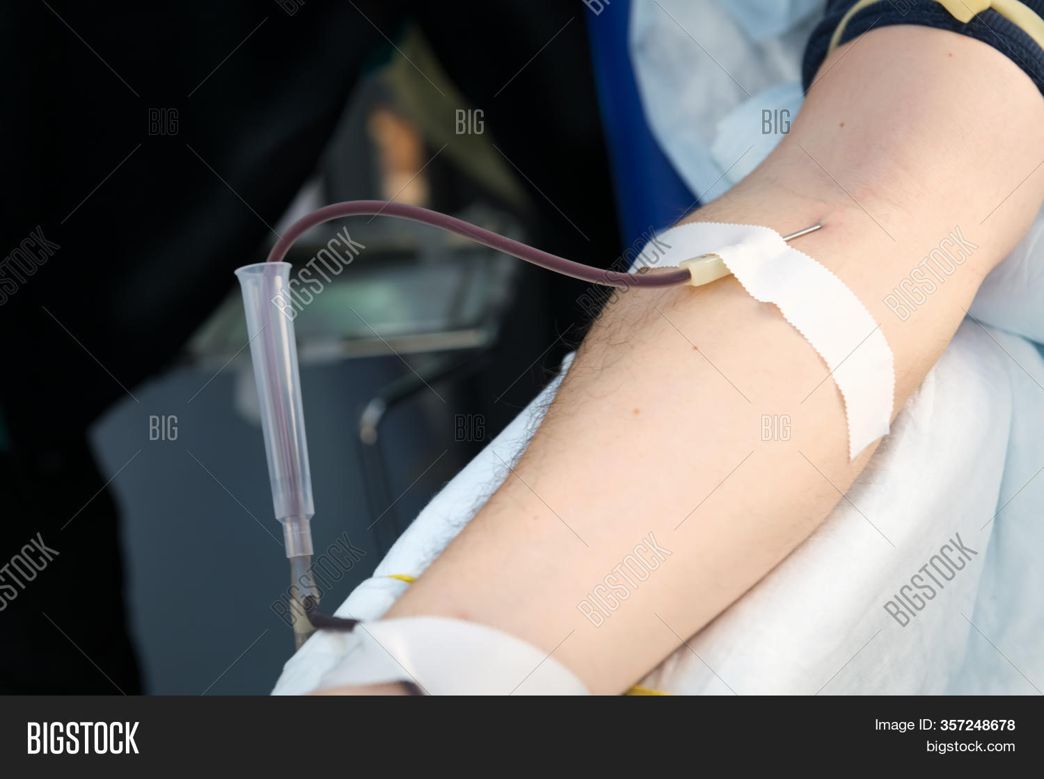 Close Arm Man Who Image & Photo (Free Trial) | Bigstock