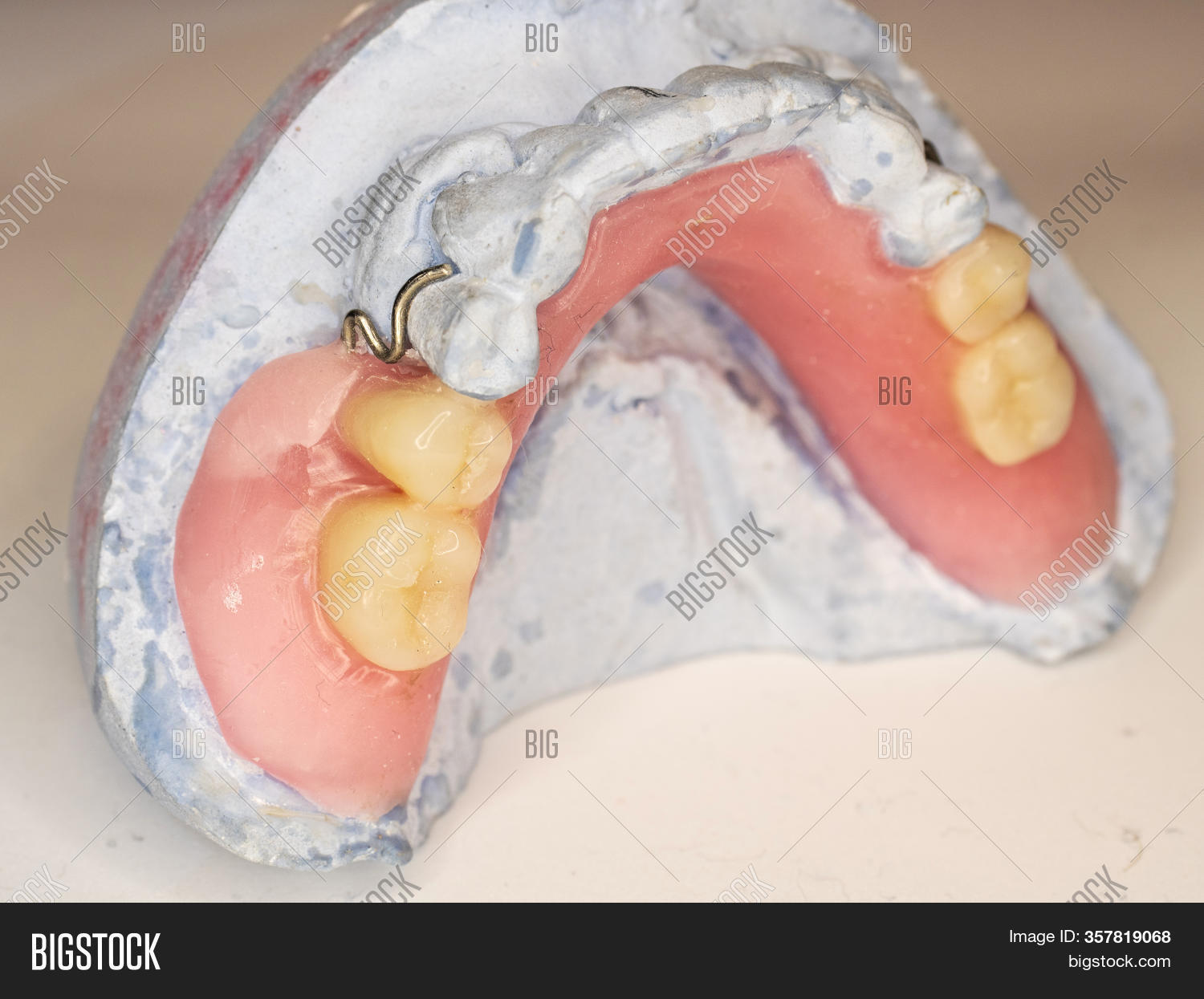 Imagen y foto Mould Human Teeth. (prueba gratis) | Bigstock