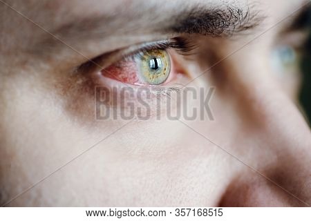 Closeup Red Eye Image & Photo (Free Trial) | Bigstock