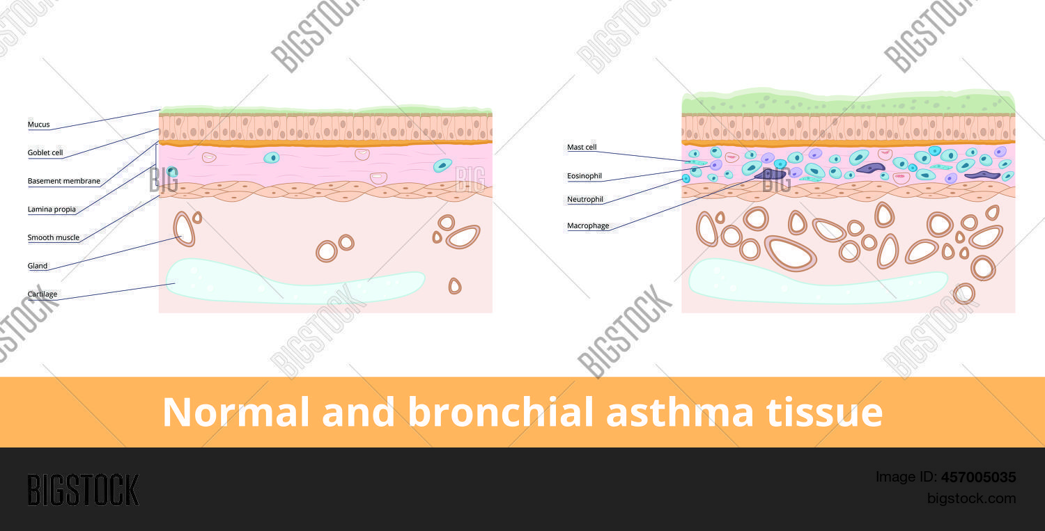 Normal Bronchial Vector & Photo (Free Trial) | Bigstock