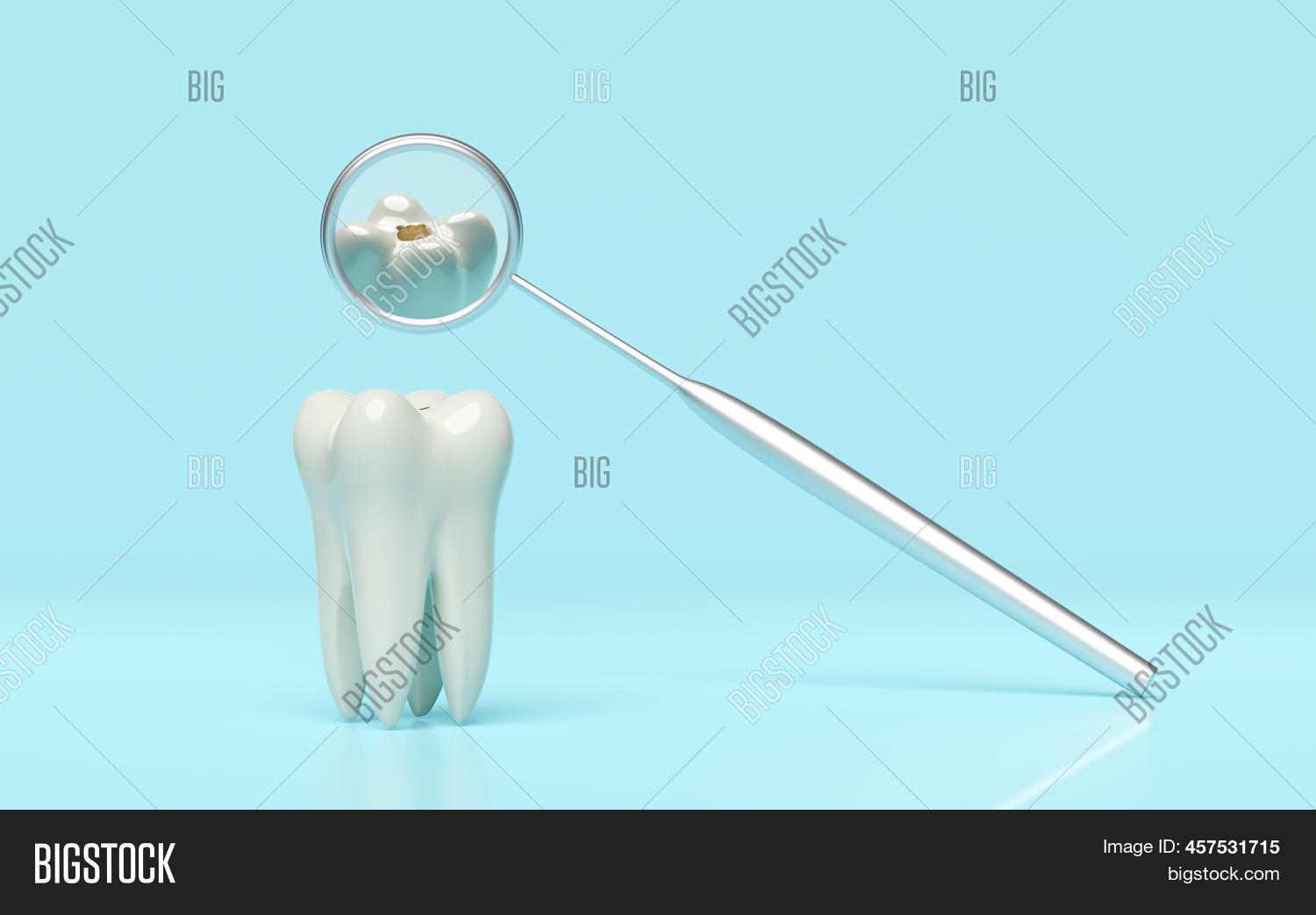 Dental Molar Teeth Image & Photo (Free Trial) | Bigstock