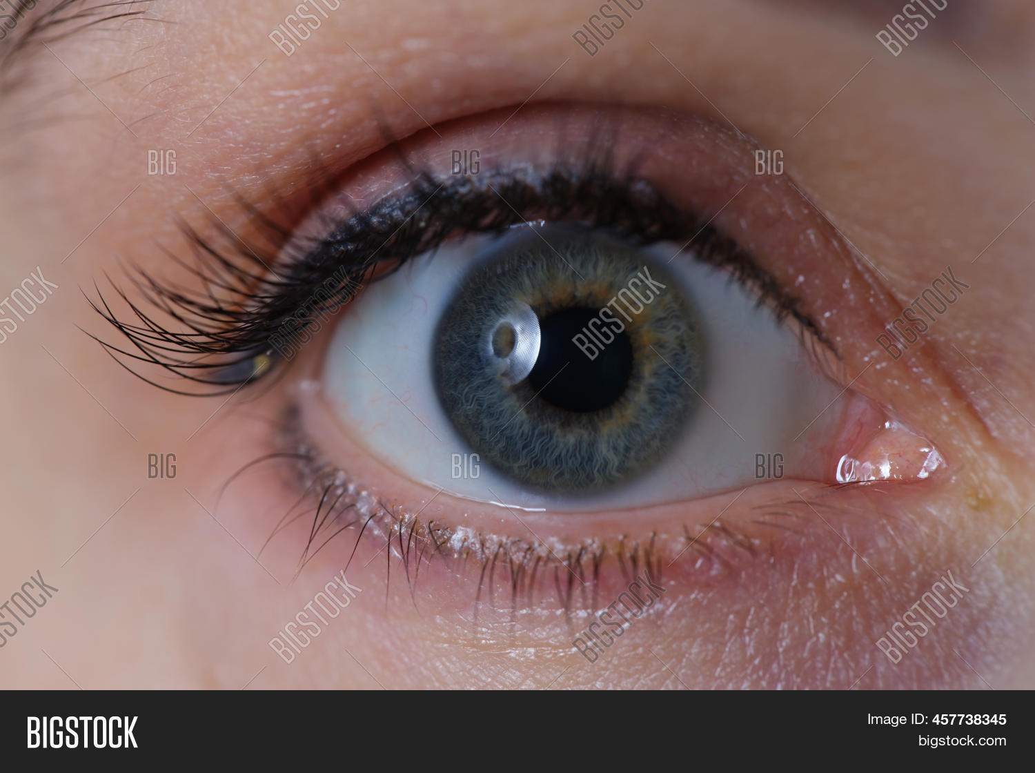 Wide Open Female Eye Image & Photo (Free Trial) | Bigstock