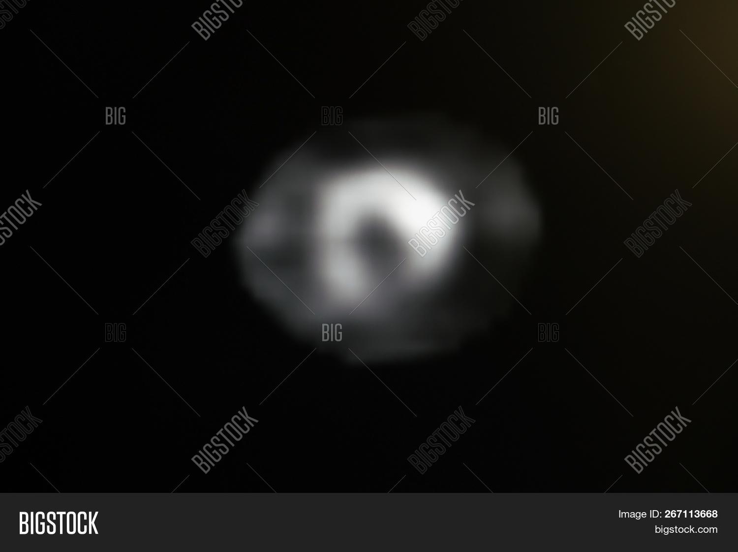Mrt Heart Coronary Image & Photo (Free Trial) | Bigstock