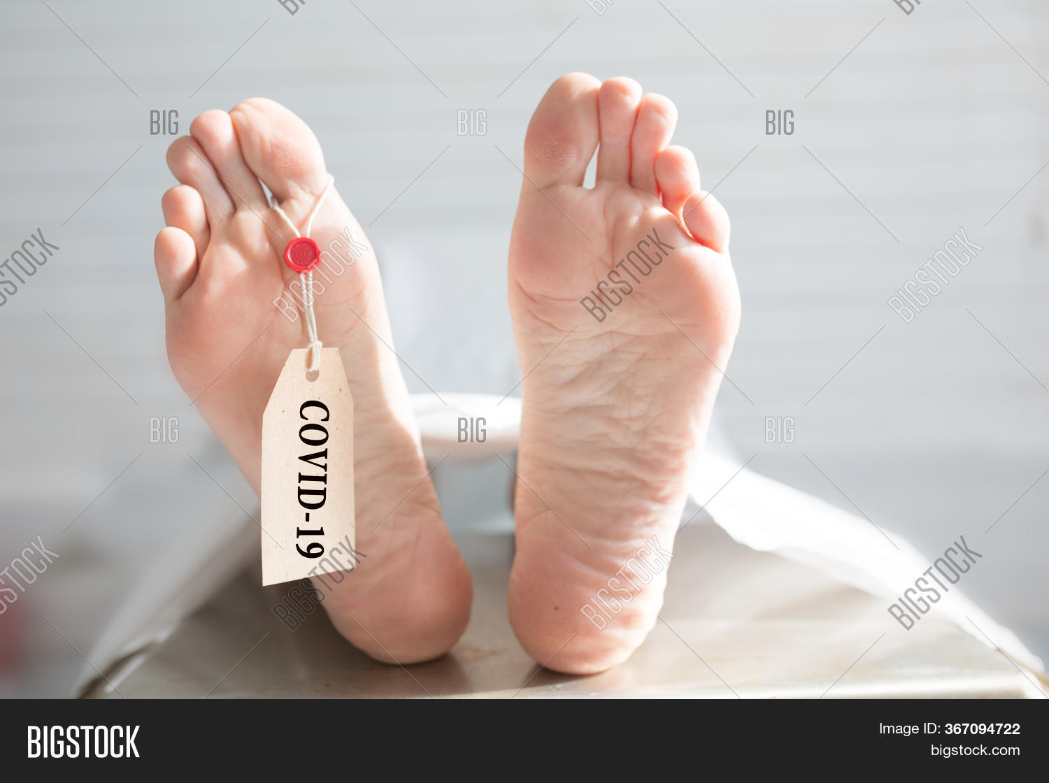Legs Corpse Morgue On Image & Photo (Free Trial) | Bigstock