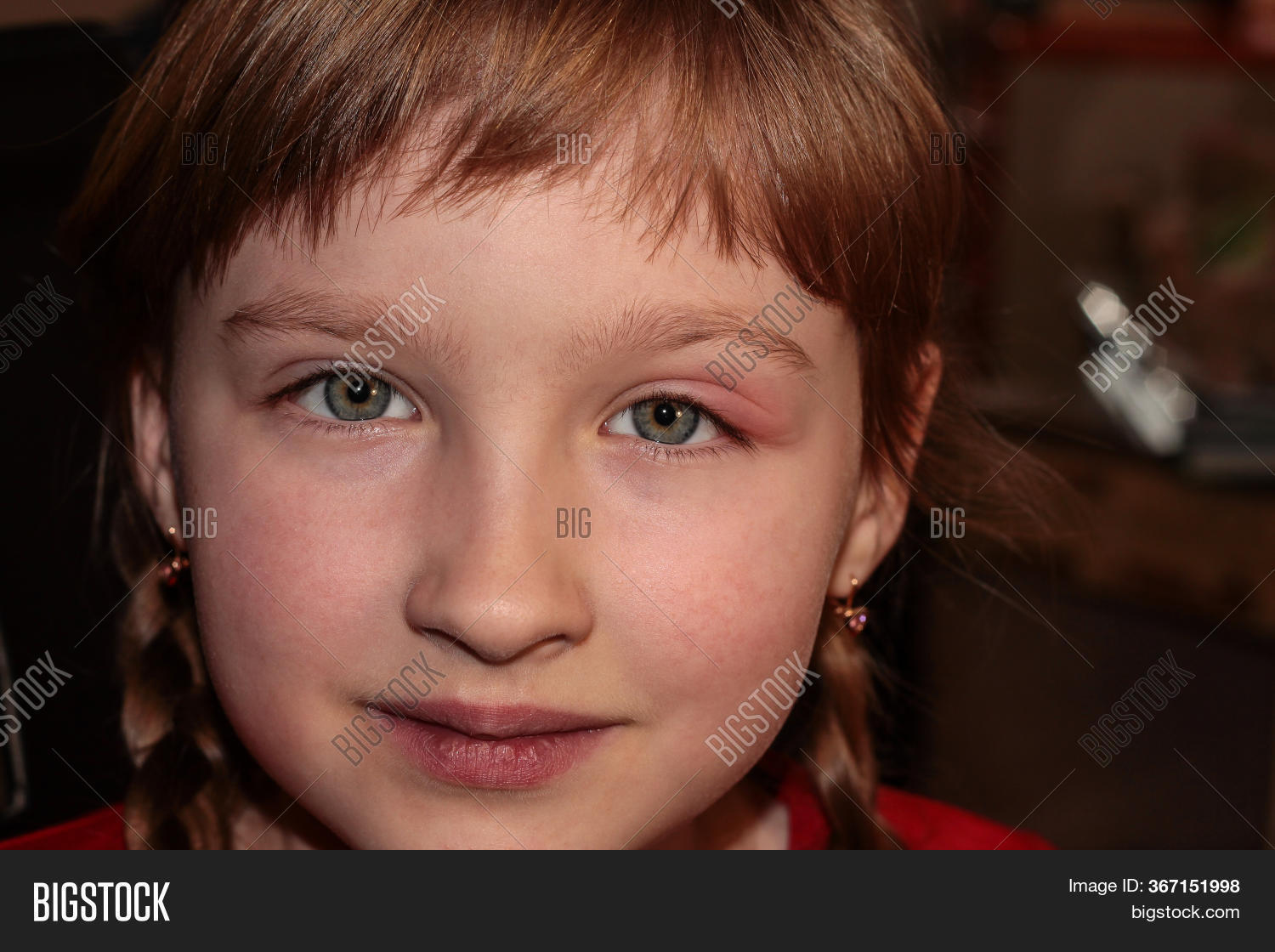 Barley Eye. 图片和照片（免费试用） | Bigstock