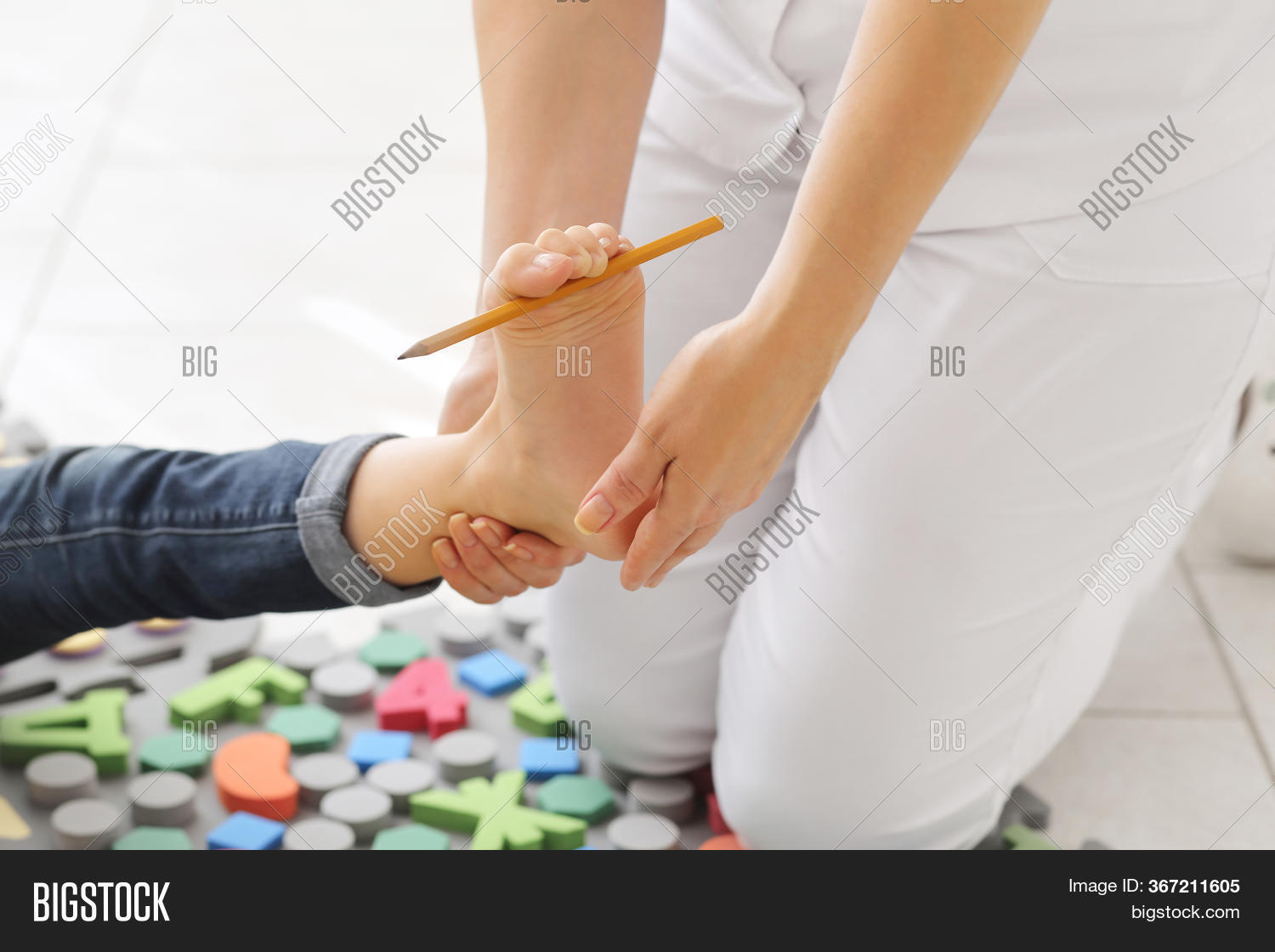 Imagen y foto Child Flatfoot (prueba gratis) | Bigstock