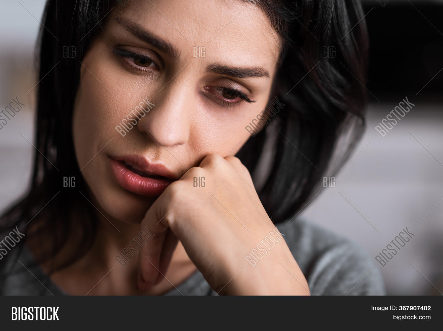 Close Injured Woman Image & Photo (Free Trial) | Bigstock