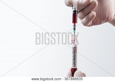 Blood Sample Flask Image & Photo (Free Trial) | Bigstock