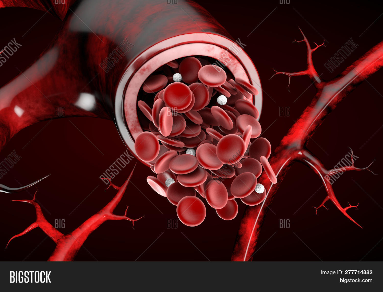 Normal Artery Red Image & Photo (Free Trial) | Bigstock