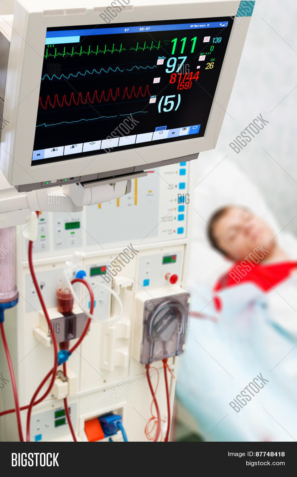 Patient Dialysis ( Image & Photo (Free Trial) | Bigstock