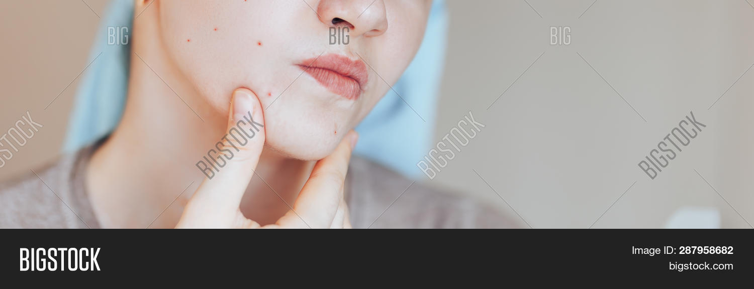 Scowling Girl Shock Image & Photo (Free Trial) | Bigstock