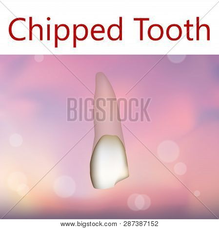 Chipped Tooth. Vector Vector & Photo (Free Trial) | Bigstock