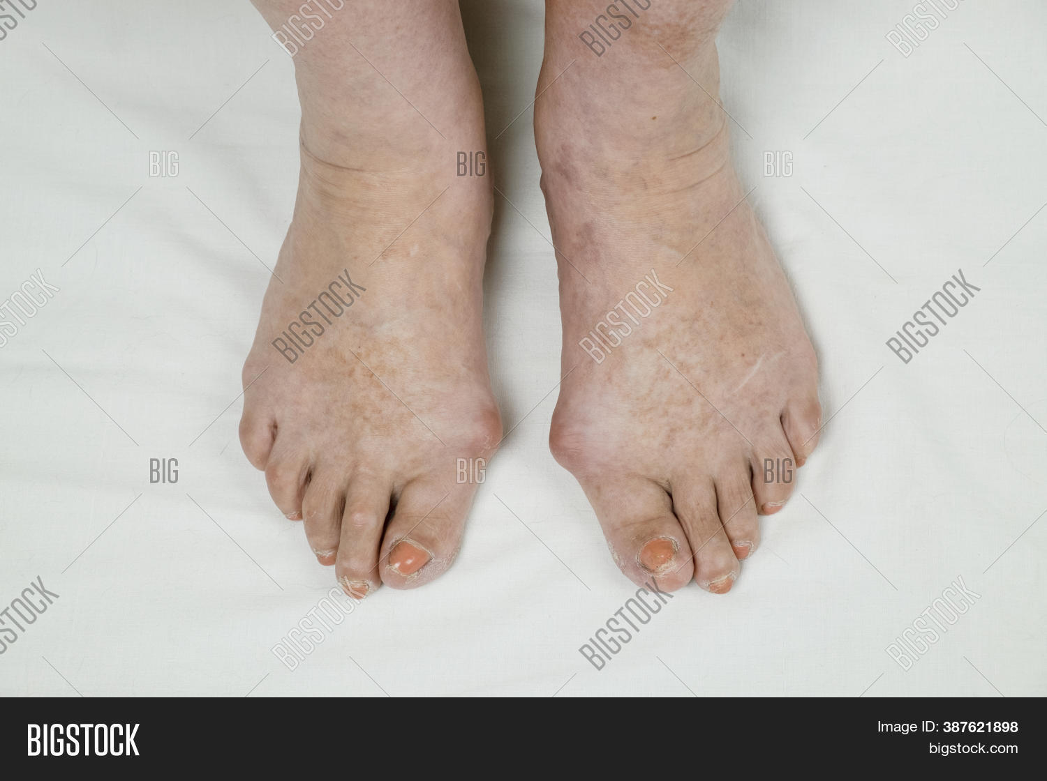 Feet Elderly Woman Image & Photo (Free Trial) | Bigstock
