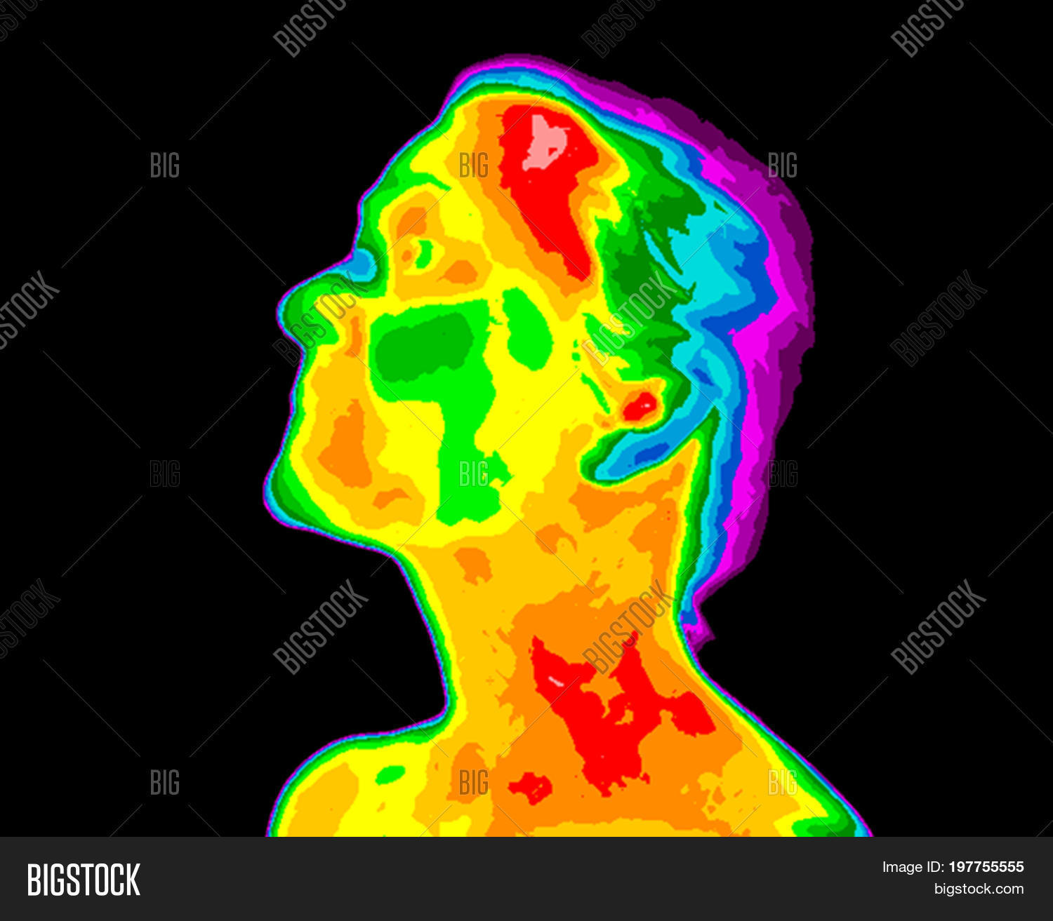 Thermographic Image Image & Photo (Free Trial) | Bigstock