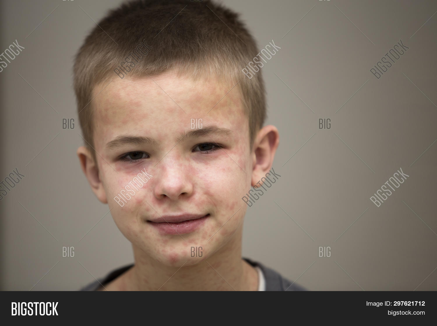 Portrait Sick Smiling Image & Photo (Free Trial) | Bigstock