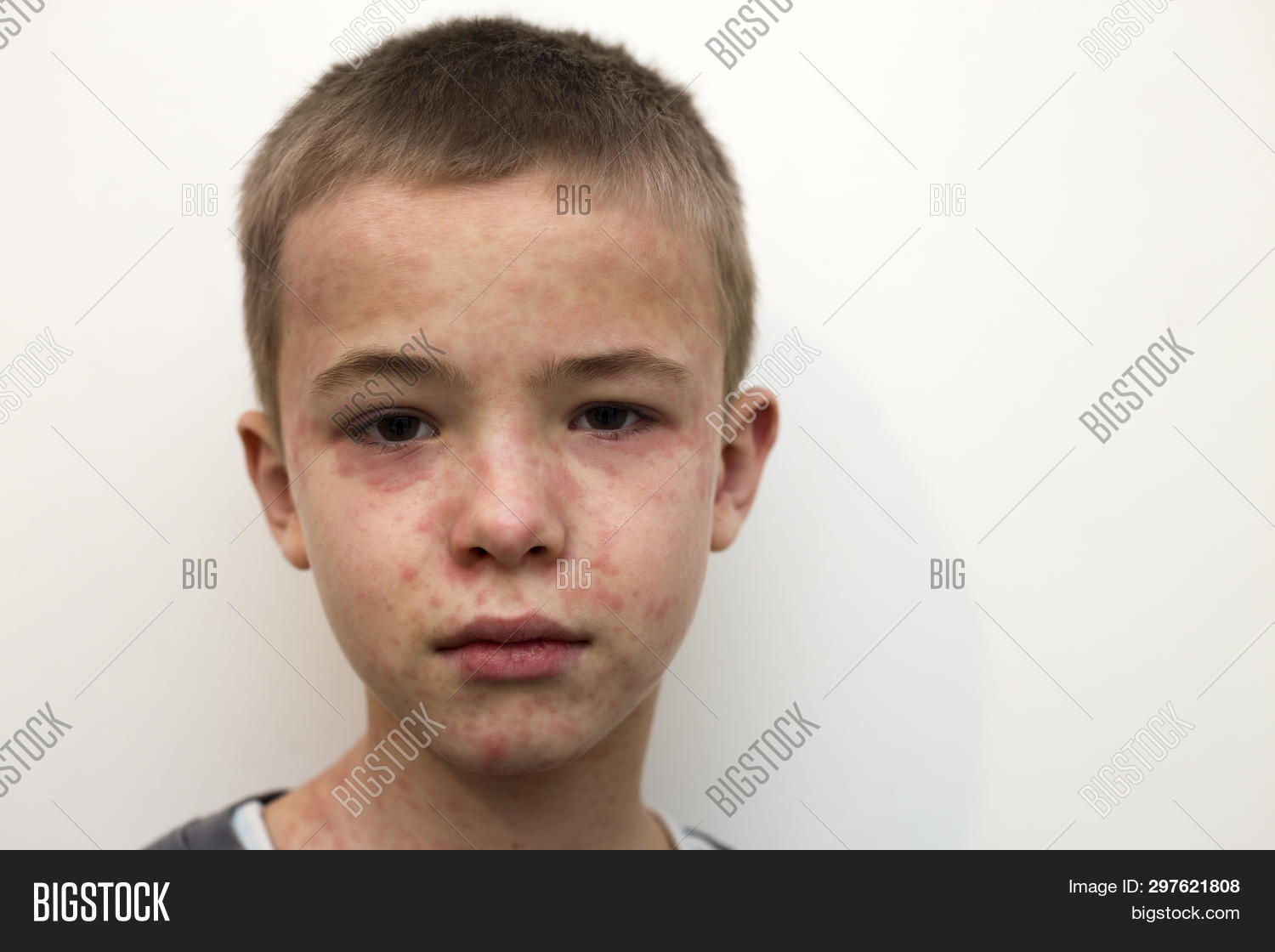 Portrait Sick Sad Boy Image & Photo (Free Trial) | Bigstock